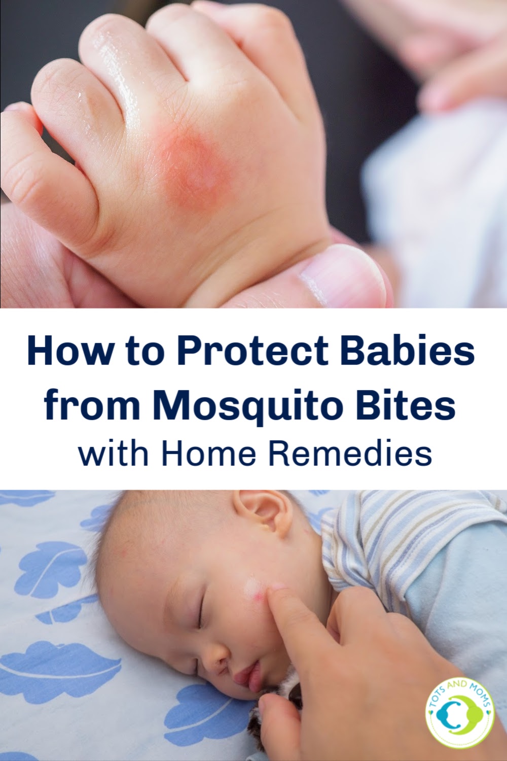 How to Protect Babies from Mosquito Bites & Home Remedies