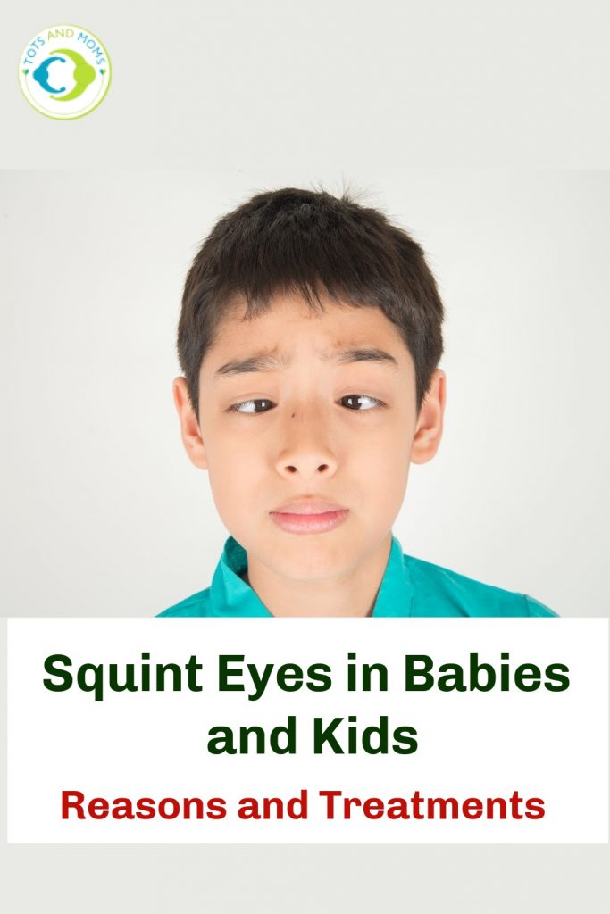 Squint Eyes in Babies and Kids - Reasons and Possible Treatments